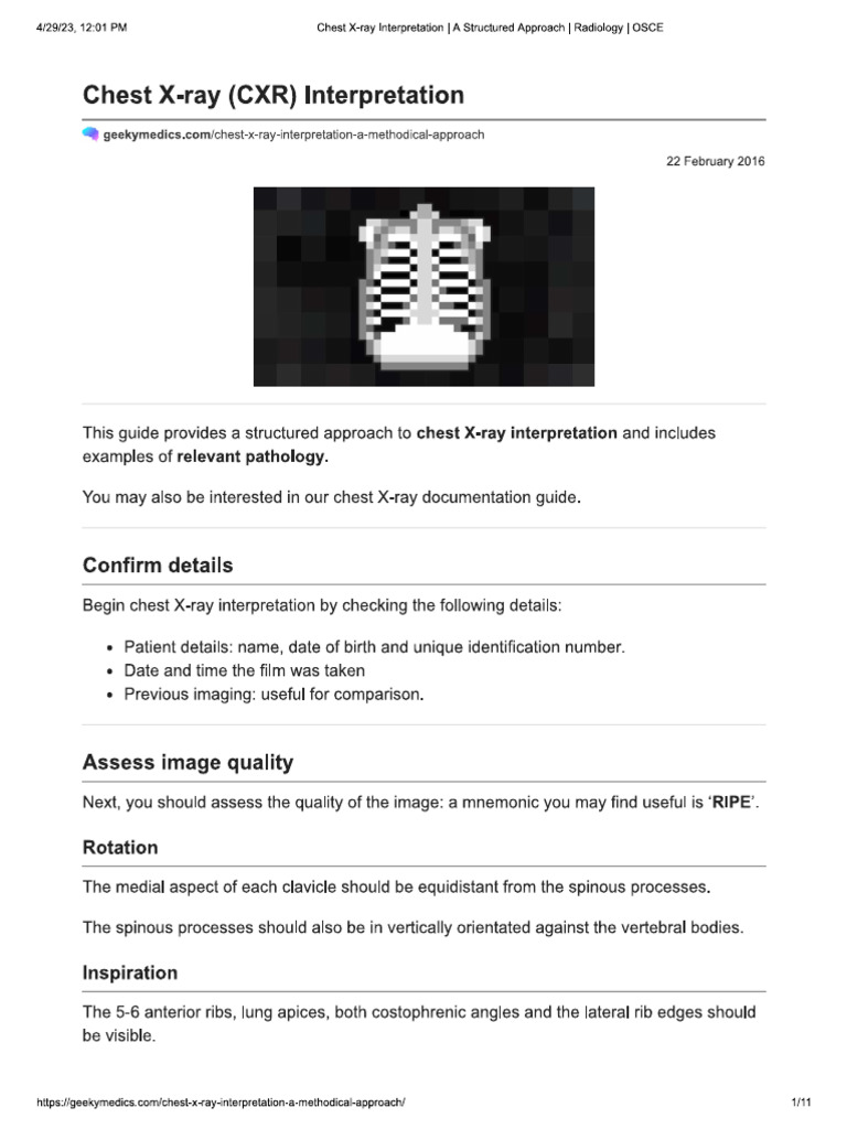 Chest Xray 2 | PDF