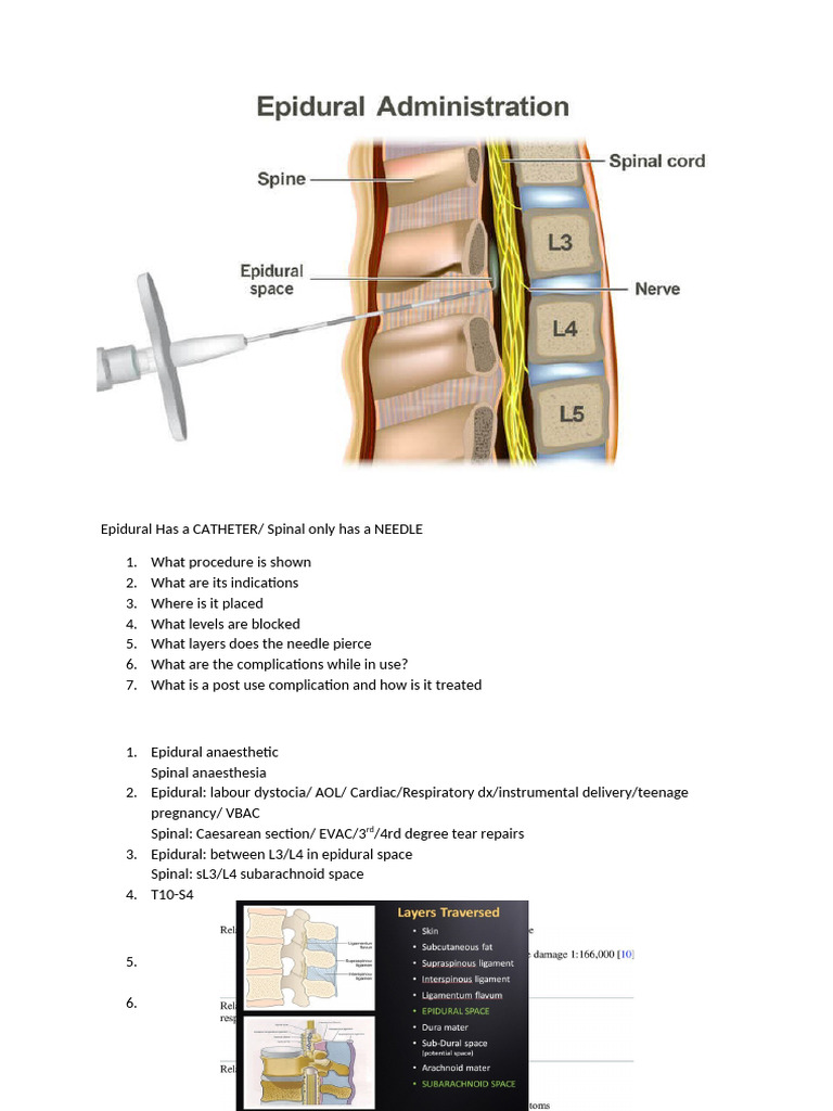 Epidural Spinal | PDF