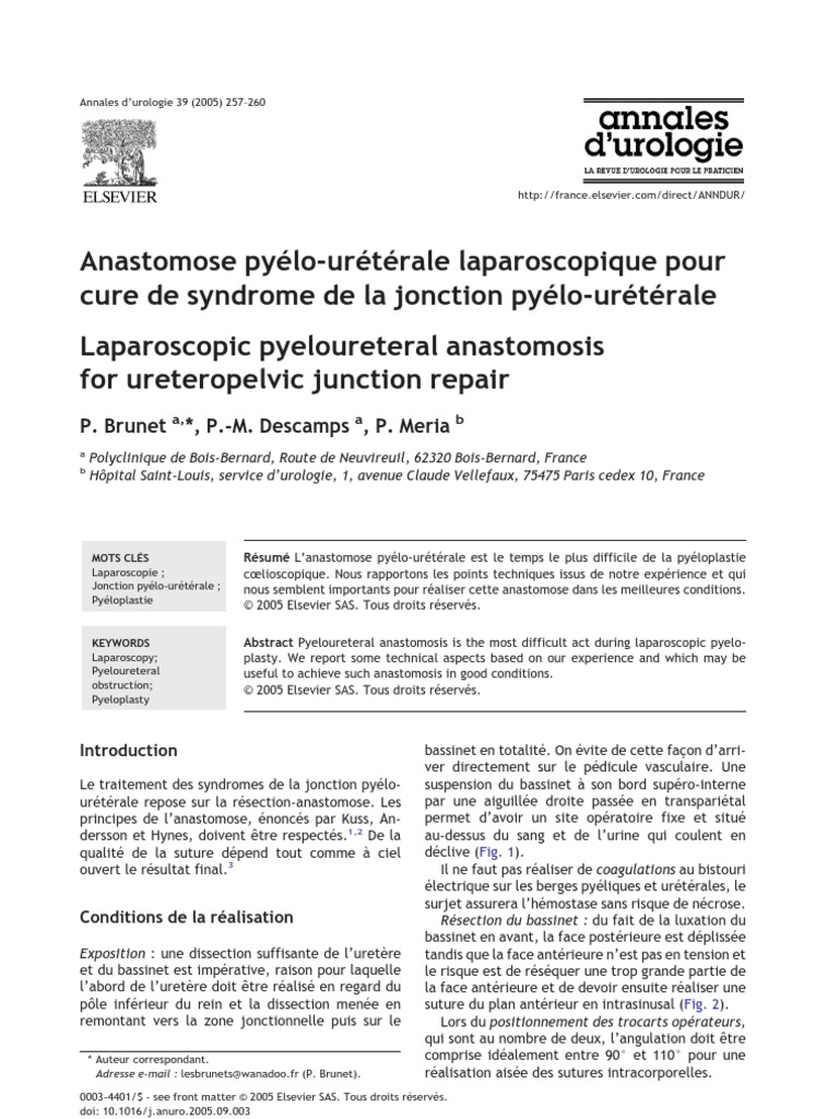 Syndrome Jonction Pyélo Urétérale – NHMRJ