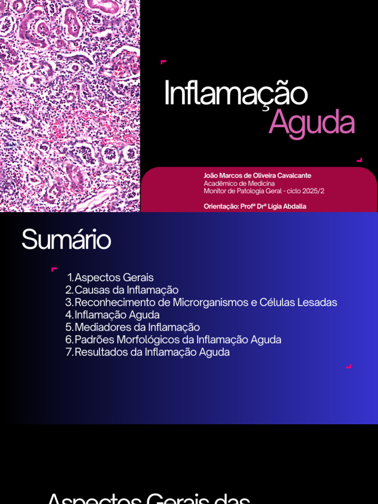 Entendendo a Inflamação Aguda: Causas e Efeitos | PDF | Quimiotaxia ...