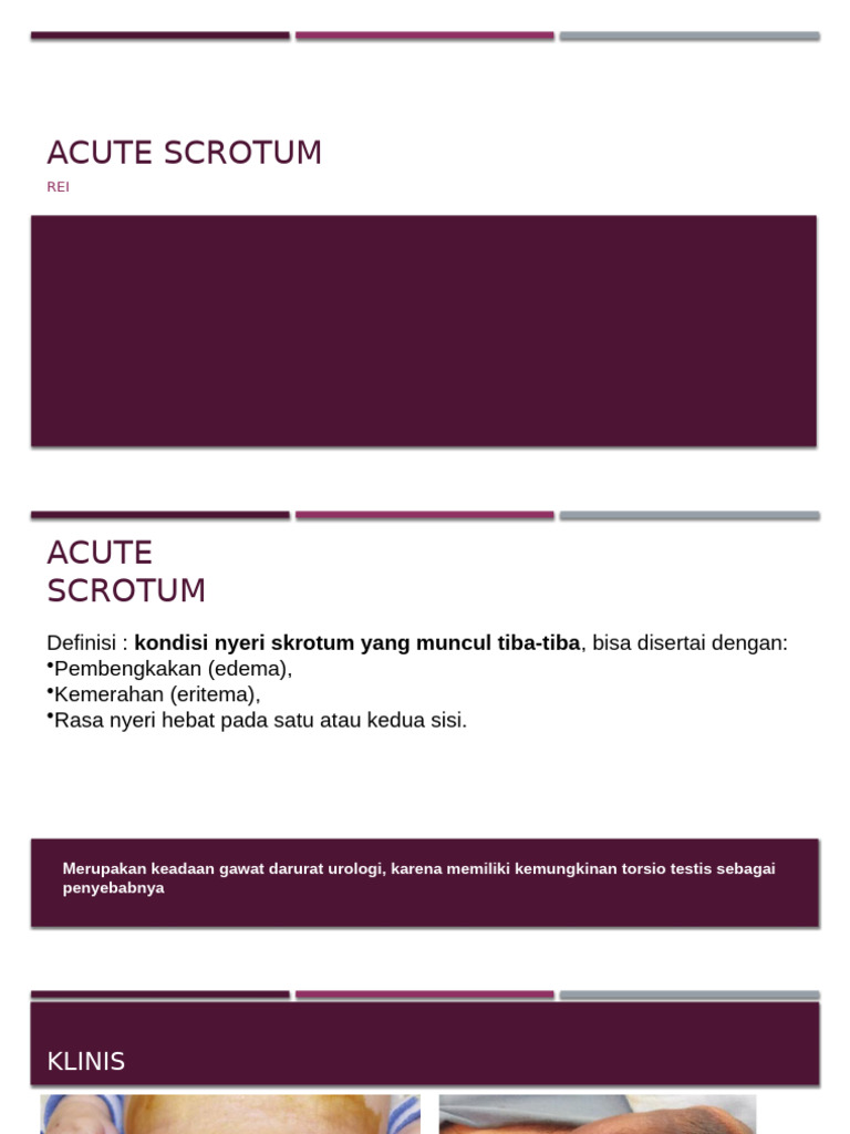 Acute Scrotum Ashcraf | PDF