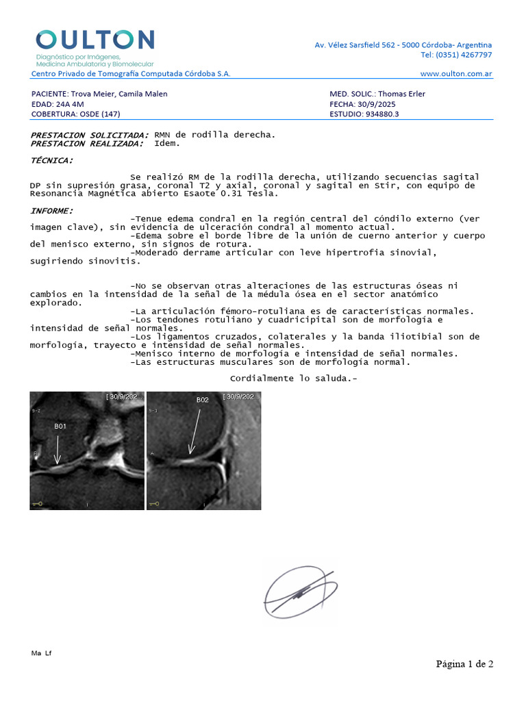 Informe | PDF | Rodilla | Articulaciones