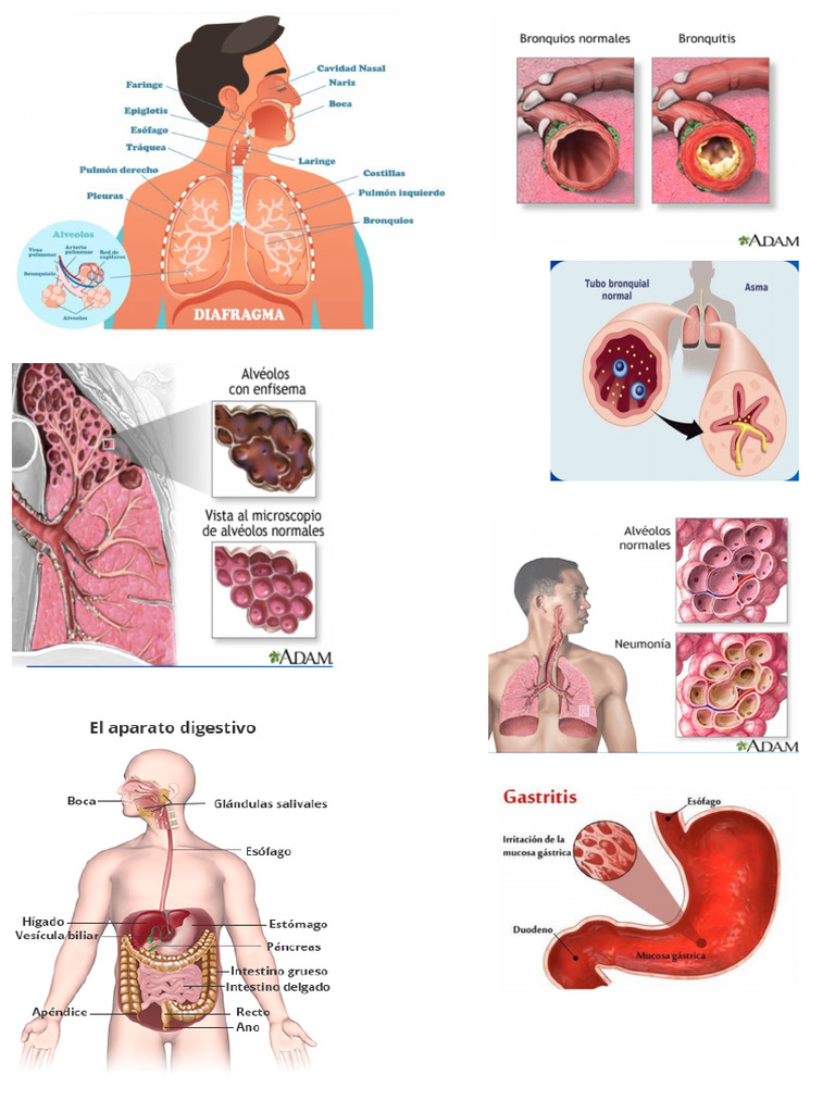 Imágenes Archivo 4 y 5 - 20251116 - 170030 - 0000 | PDF