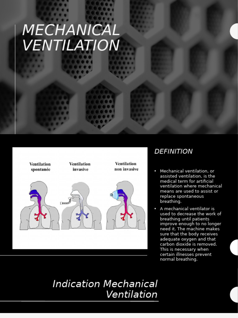 Understanding Mechanical Ventilation Basics | PDF | Breathing | Exhalation