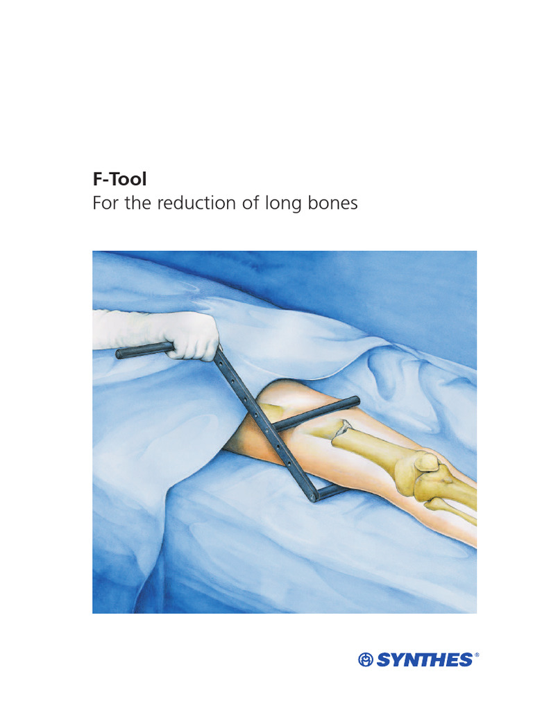 F-Tool for Long Bone Reduction | PDF | Screw | Musculoskeletal System