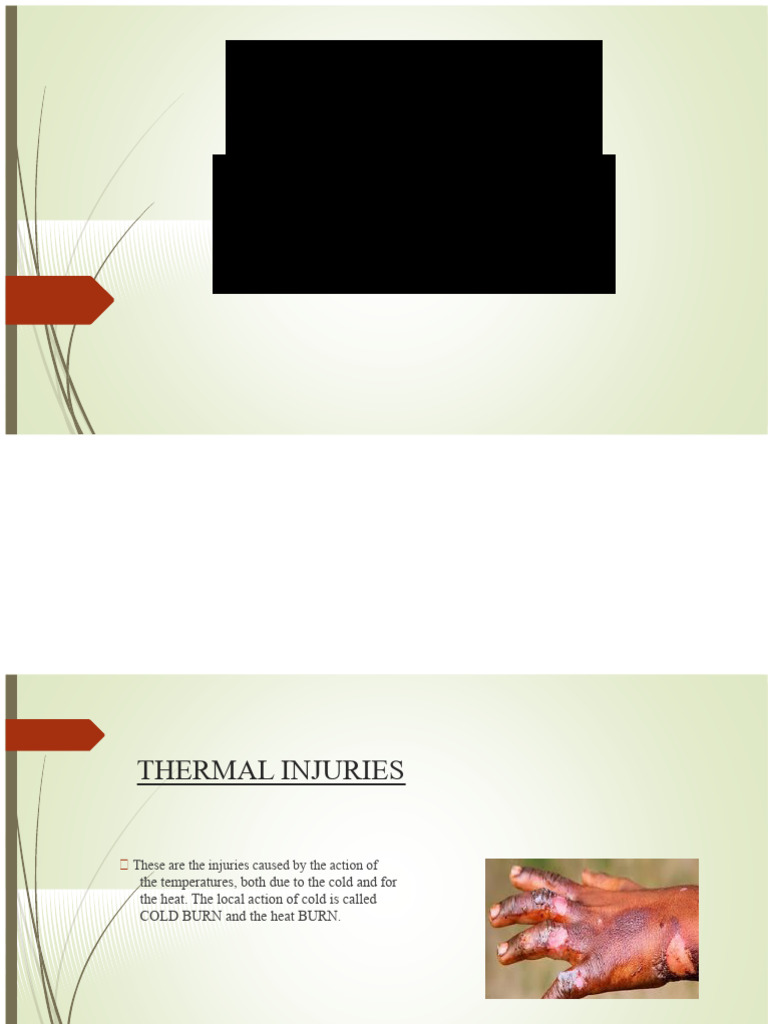 Thermal Injuries | PDF | Burn | Medical Specialties
