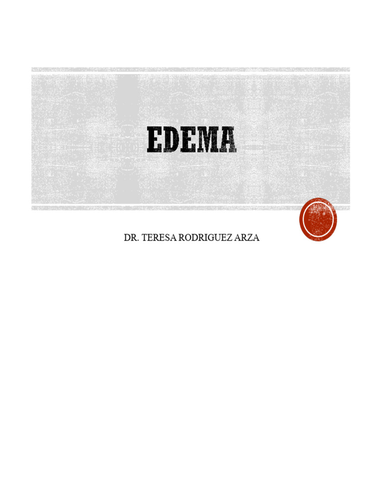 Understanding Edema Syndrome: Types & Causes | PDF | Edema | Diseases ...