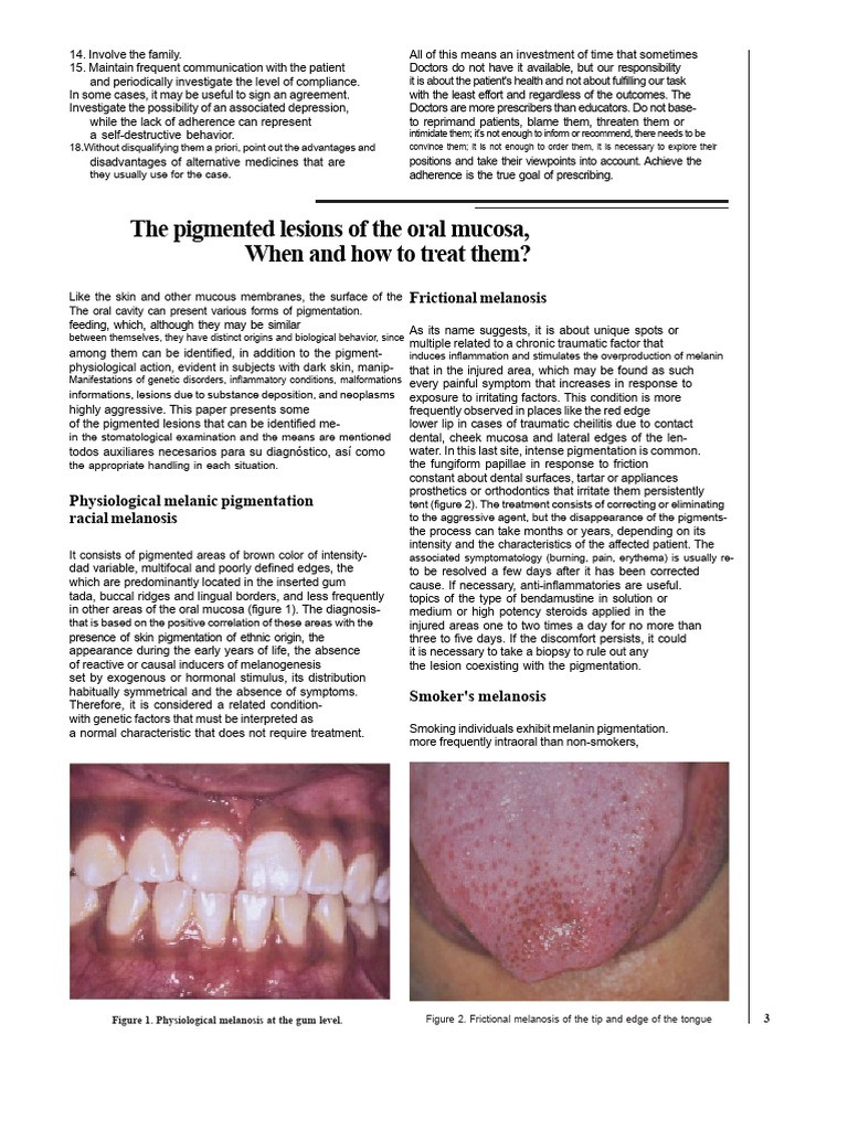Pigmented Lesions of The Oral Mucosa. When and How To Treat Them. | PDF ...