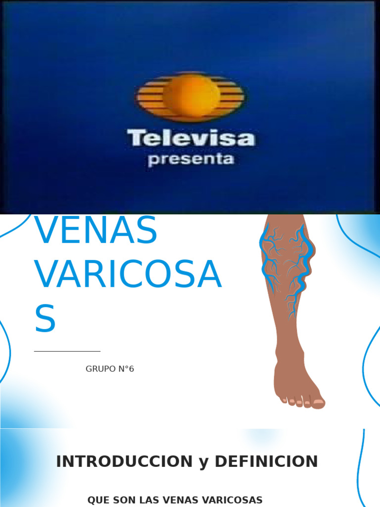Venas Varicosas | PDF | Venas varicosas | Enfermedades y trastornos humanos