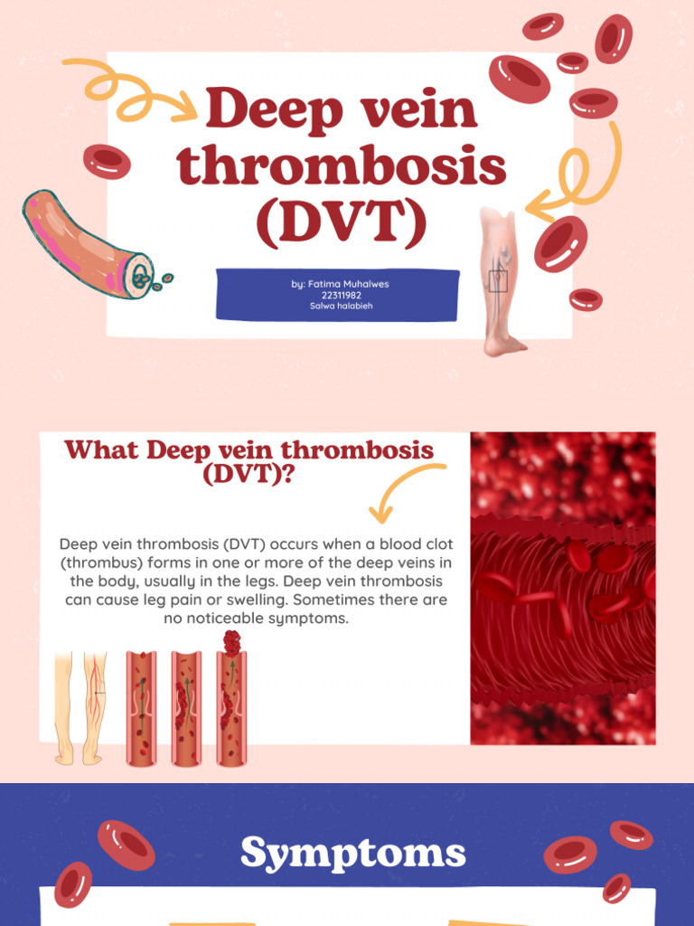 Deep Vein Thrombosis (DVT) PDF | PDF