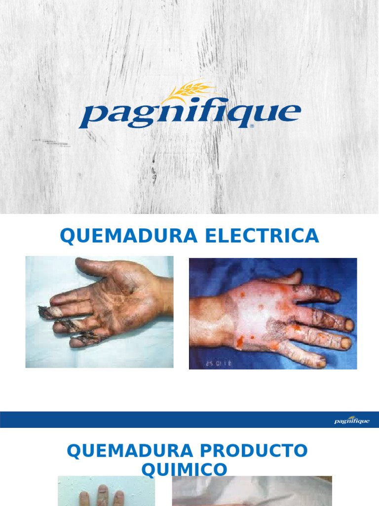 Cap. Meeting Febrero | PDF
