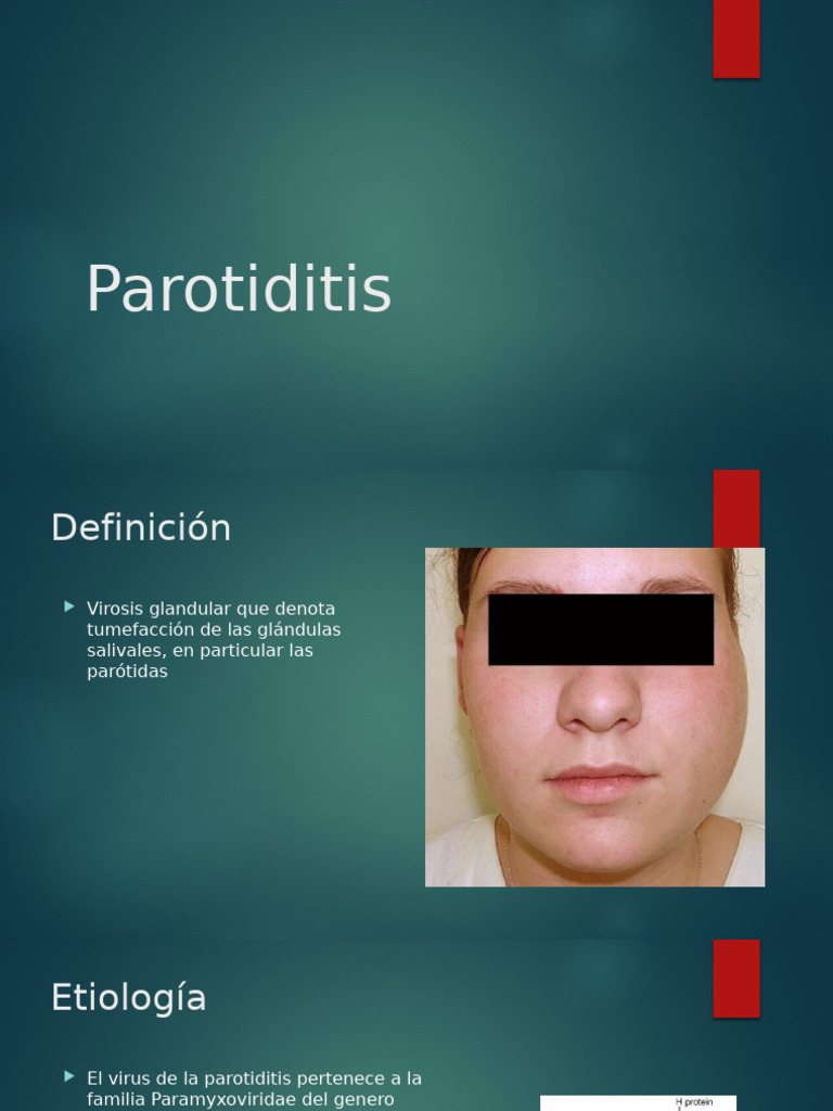 2 Parotiditis | PDF | Medicina CLINICA | Inmunología
