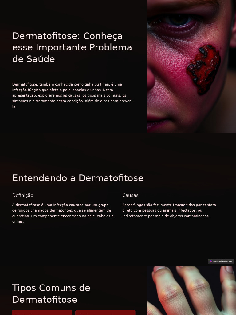 Dermatofitose: Causas, Sintomas e Tratamento | PDF | Unha | Doenças e ...