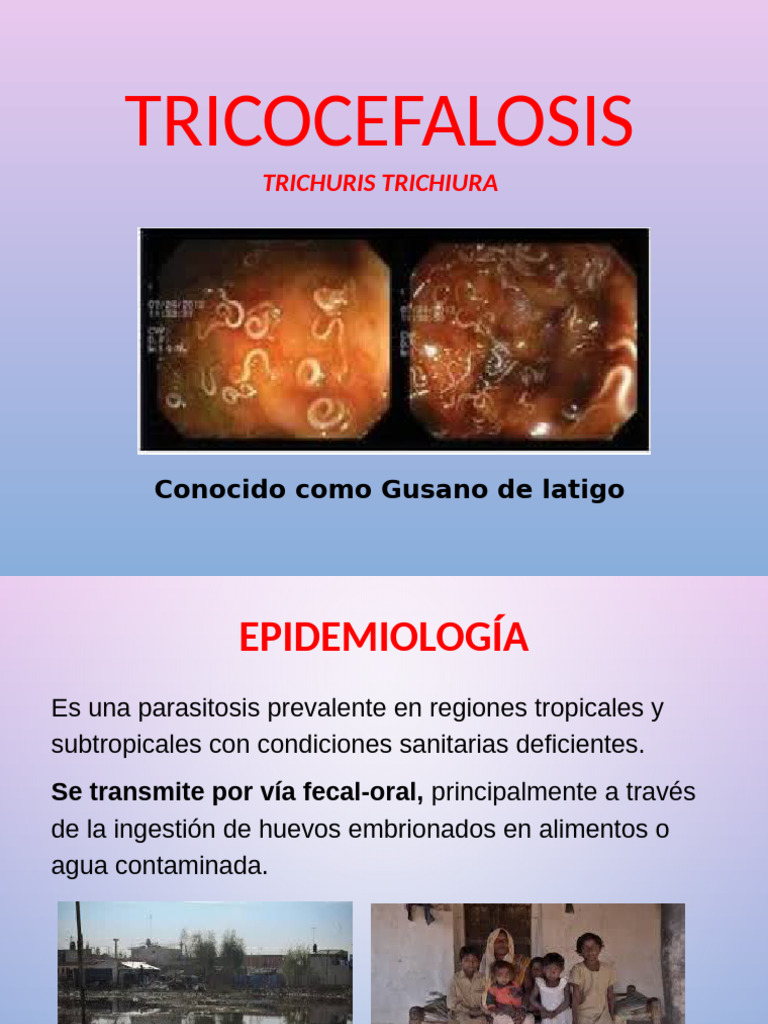 Tricocefalosis, Oxiuriasis y Teniasis APSR | PDF | Especialidades Medicas | Enfermedades y ...