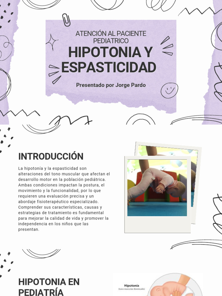 Hipotonía y Espasticidad en Pediatría | PDF