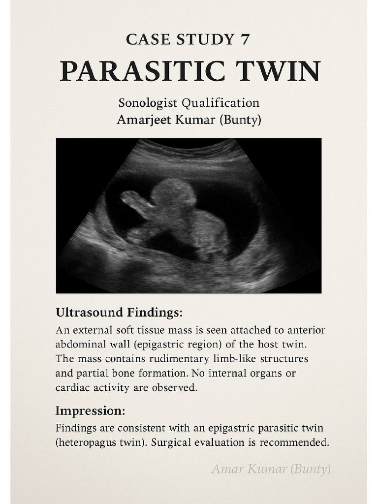Case - 7. Parasitic Twin | PDF