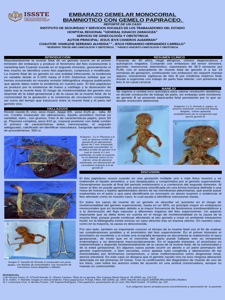 Cartel Gemelo Muerto | PDF | El embarazo | Feto