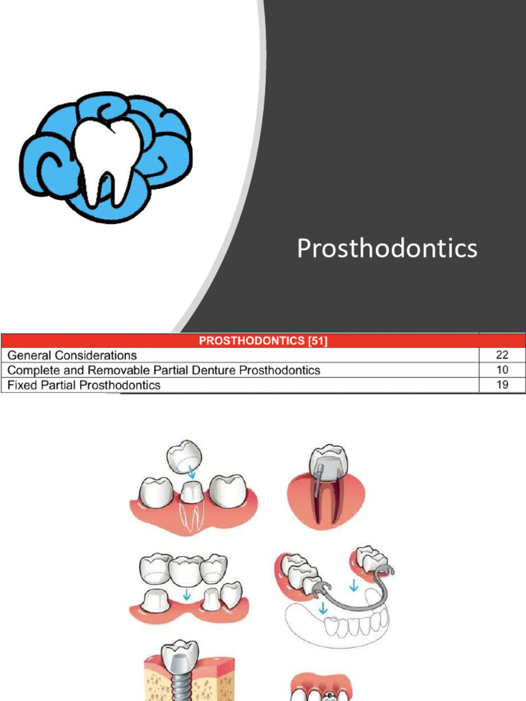 Removable Prosthodontics | PDF | Dentures | Dental Implant
