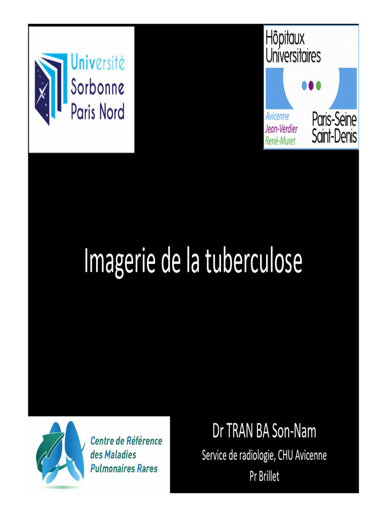 Imagerie de la tuberculose pulmonaire | PDF | Tuberculose | Spécialités ...
