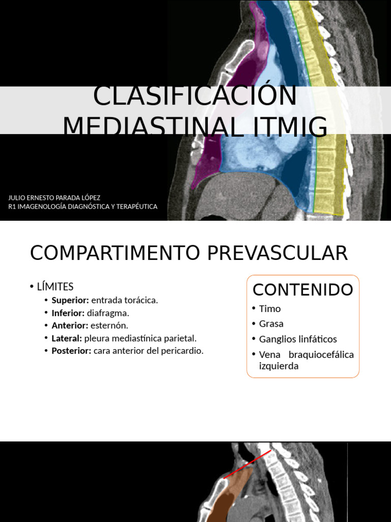 Clasificación Mediastinal Itmig | PDF | Tórax | Sistema circulatorio