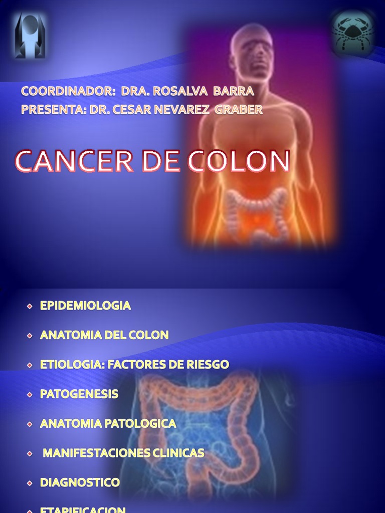 Cancer de Colon | Cáncer colonrectal | Cáncer