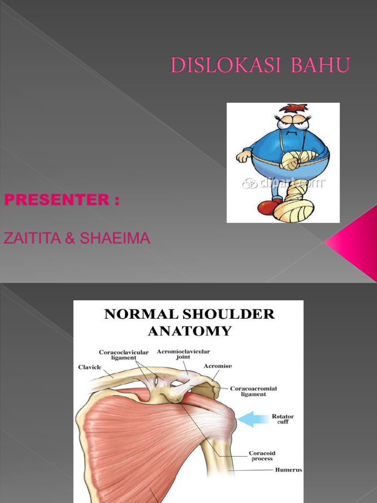 Dislokasi Bahu | PDF | Shoulder | Anatomical Terms Of Motion