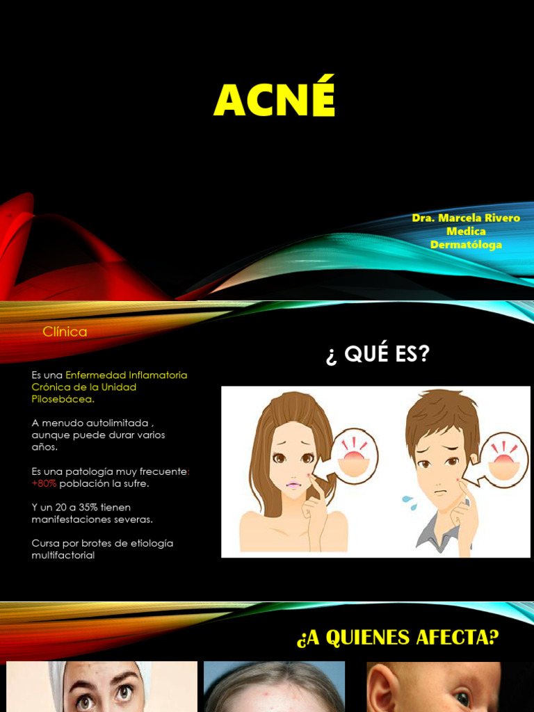 Guía Completa sobre el Acné y su Tratamiento | PDF | Especialidades ...