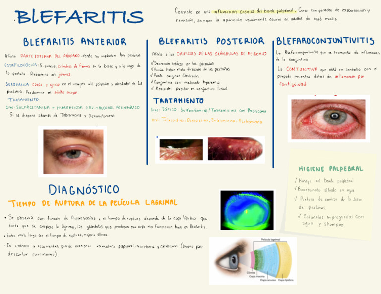 Blefaritis | PDF | Medicina CLINICA | Enfermedades y trastornos