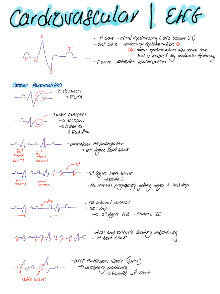 EKG - Some Common Ecg | PDF