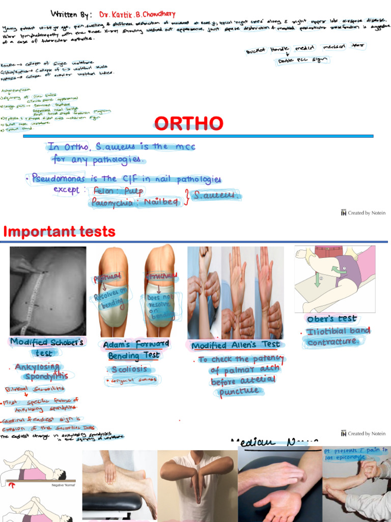 Orthopedic Tests and Nerve Injuries Guide | PDF | Elbow | Arm