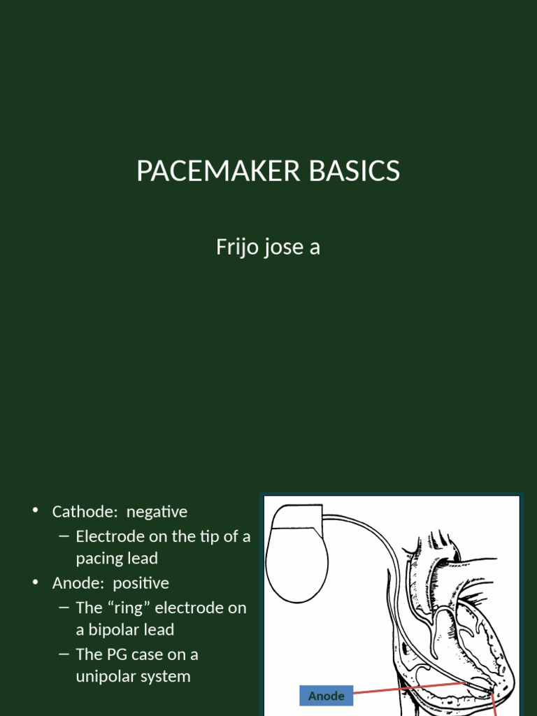 Pacemaker Basics -Dr Frijo (1) | PDF | Atrium (Heart) | Anode