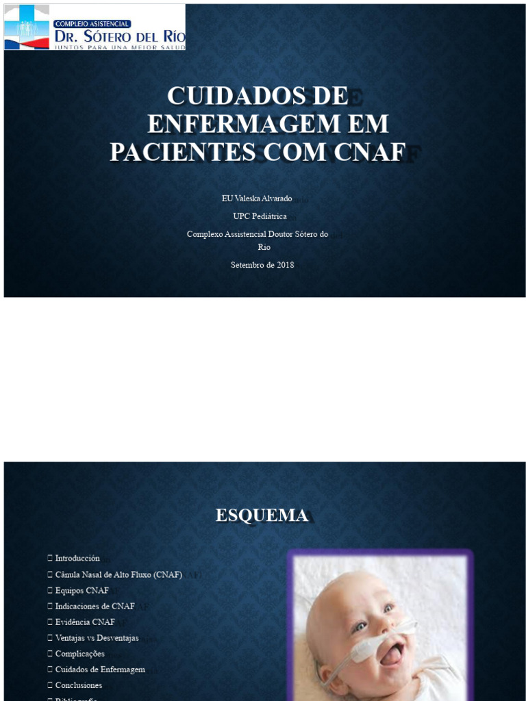 Cuidados de Enfermagem em Pacientes Com CNAF | PDF | Oxigênio | Respiração