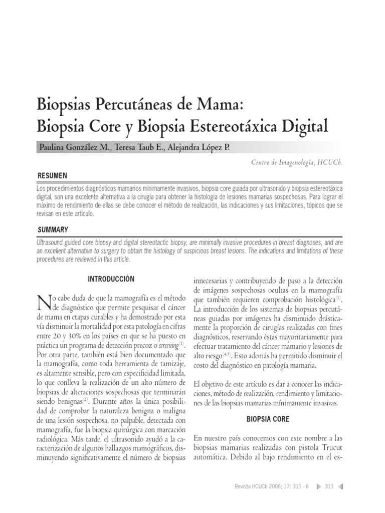 Biopsias Percutáneas de Mama: Guía Completa | PDF | Cáncer de mama ...