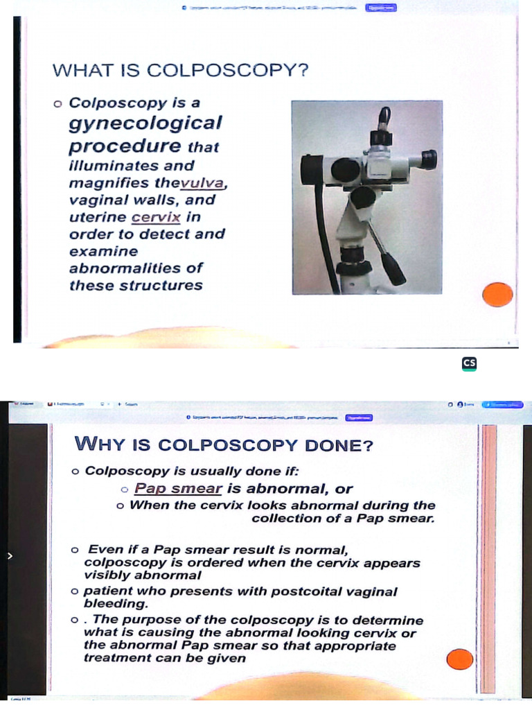 Colposcopy Lect 3 | PDF