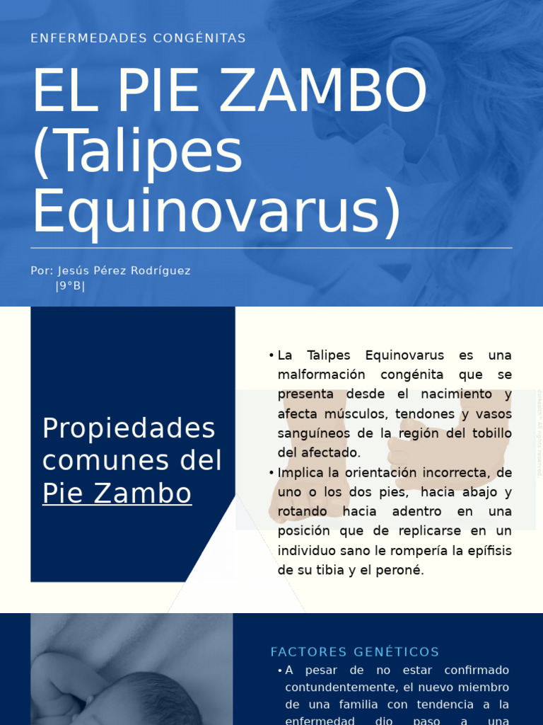 El Pie Zambo (Club Foot) | PDF | Enfermedades y trastornos ...