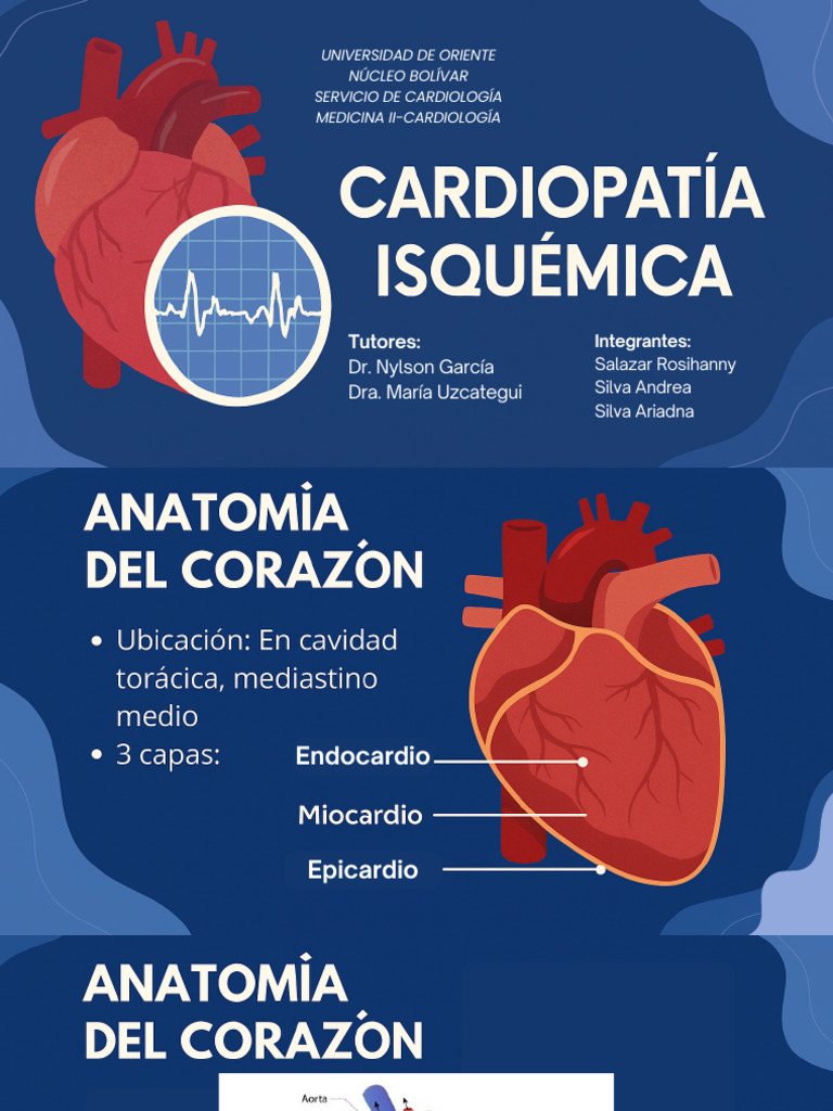 Cardiopatía Isquémica | PDF | Infarto de miocardio | Aterosclerosis