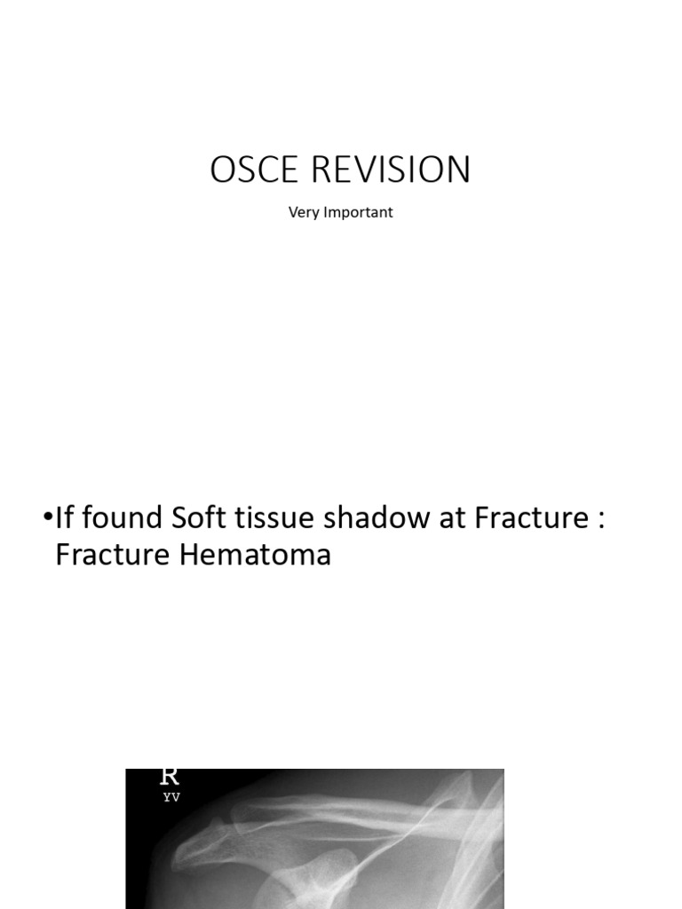 Osce Revision: Very Important | PDF | Elbow | Shoulder