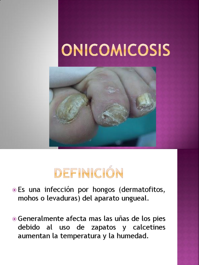 Onicomicosis: Tipos y Tratamiento | PDF | Epidemiología | Medicina