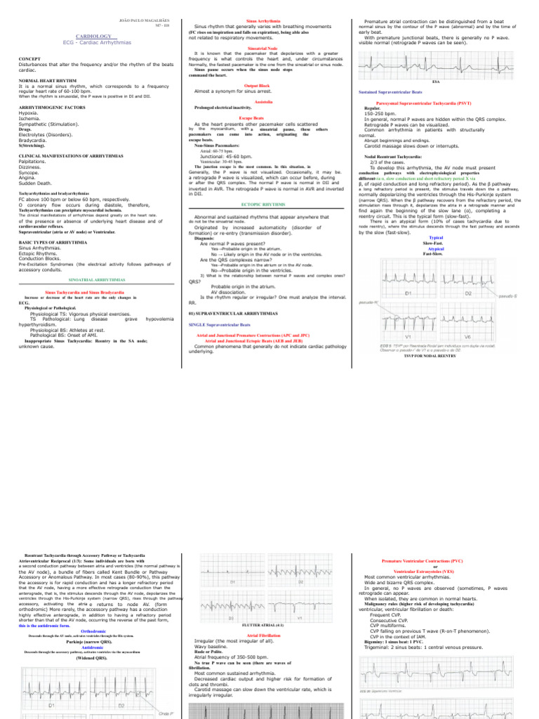 Summary ECG Arrhythmias 1 | PDF | Heart | Cardiovascular Physiology