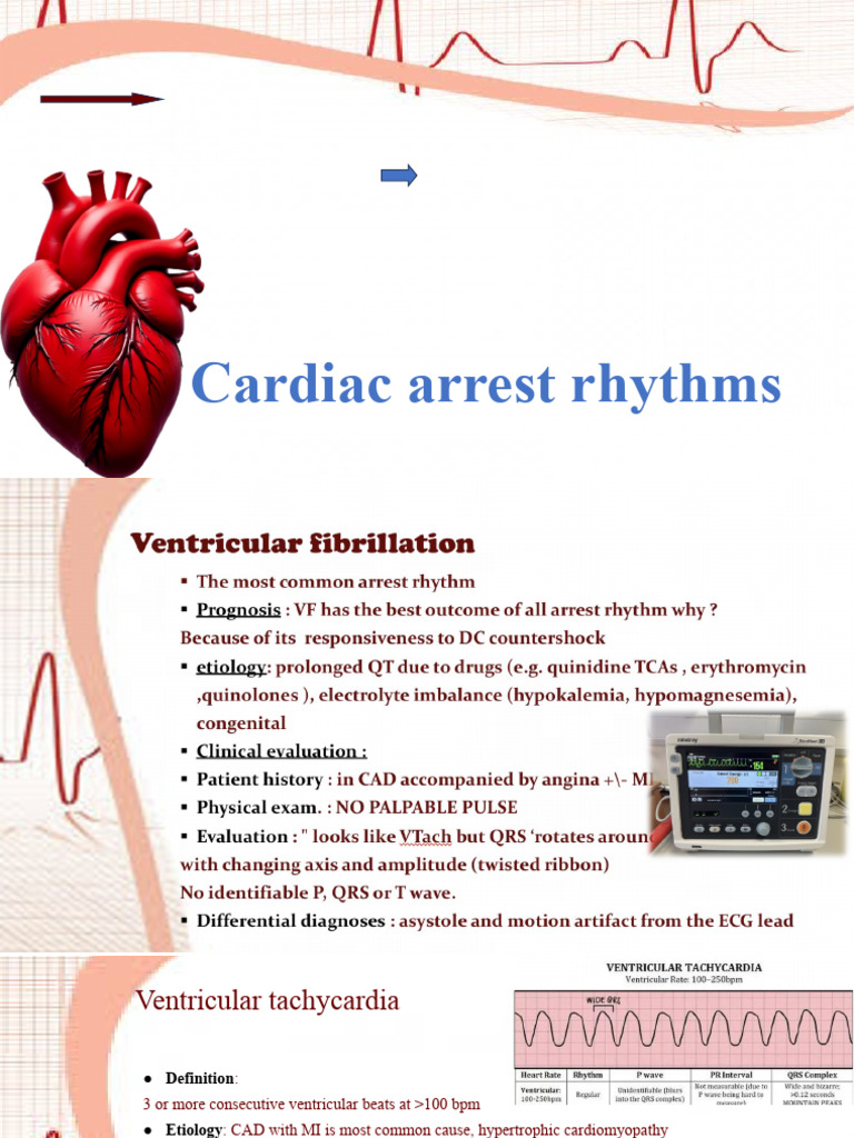Cardiac Arrest Rhythm | PDF