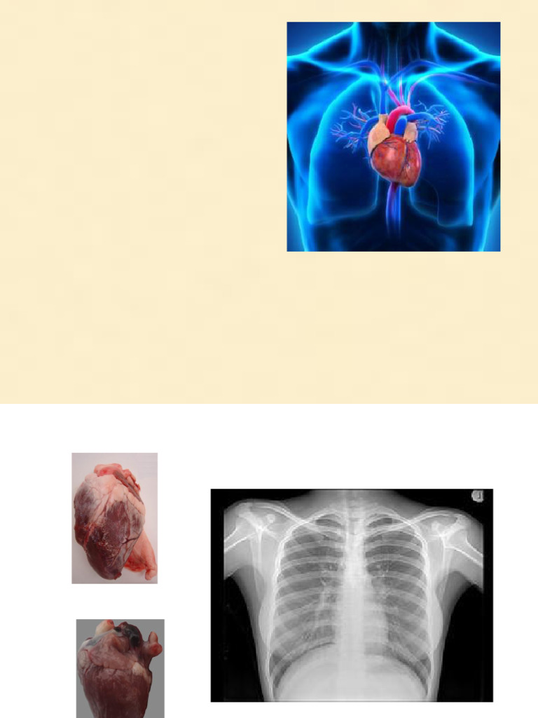 10-Heart and Blood Vessels | PDF | Heart Valve | Heart