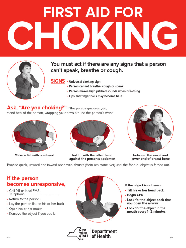 First Aid for Choking: Heimlich Maneuver | PDF