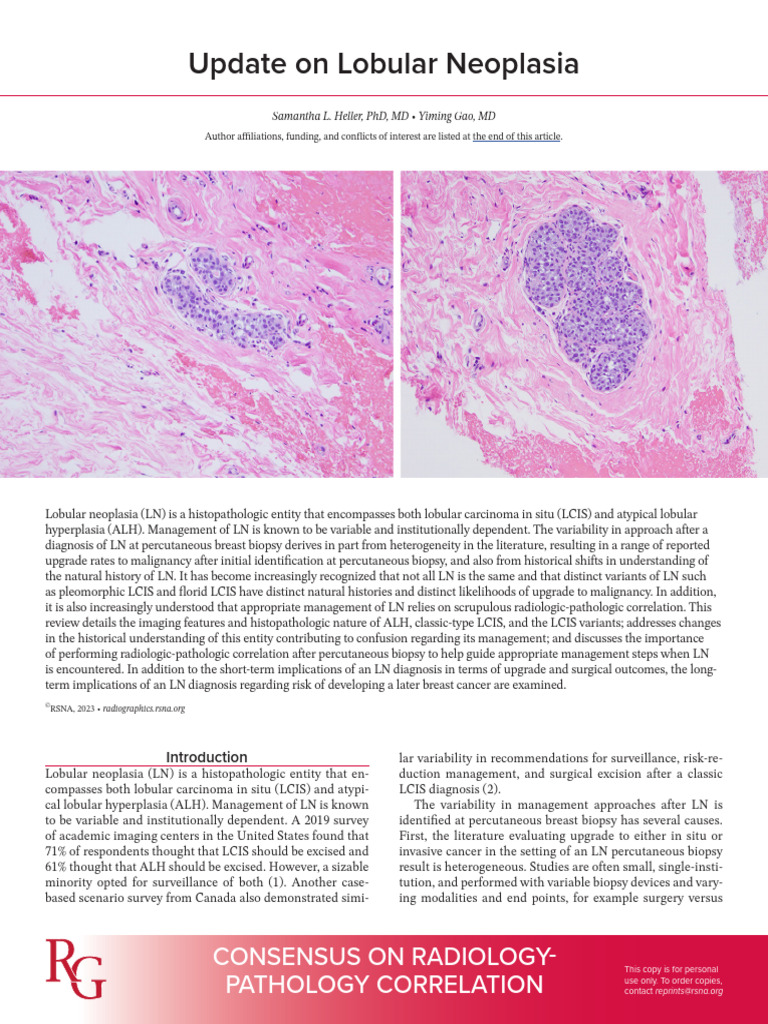 2023 Update On Lobular Neoplasia Radiographics | PDF | Medical ...