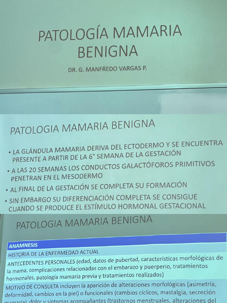 Patologia Mamaria Benigna | PDF