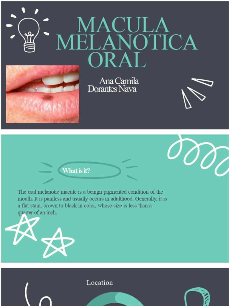 Understanding Oral Melanotic Macules | PDF