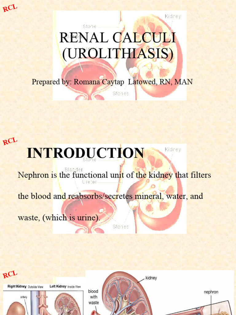 Renal Calculi | PDF | Kidney | Genitourinary System