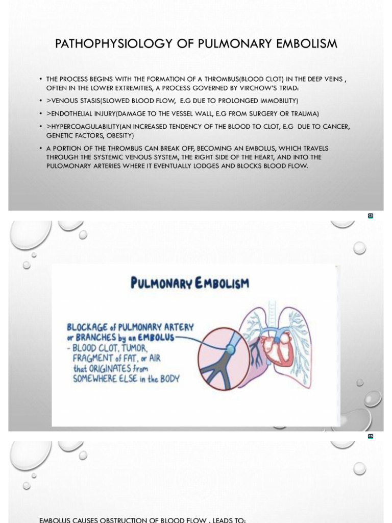 Pathophysiology of Pulmonary Embolism | PDF