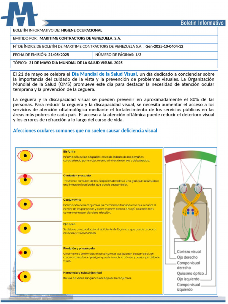 DA118908_Es.doc. Boletin Informativo Rev HIGIENE 21 de MAYO El Día Mundial de La Salud Visual ...