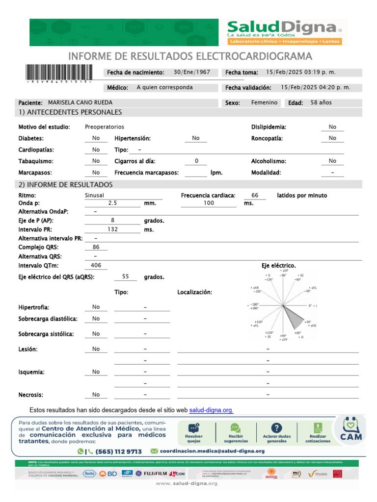 Informe ECG Preoperatorio Marisela Cano | PDF | Corazón | Sistema ...