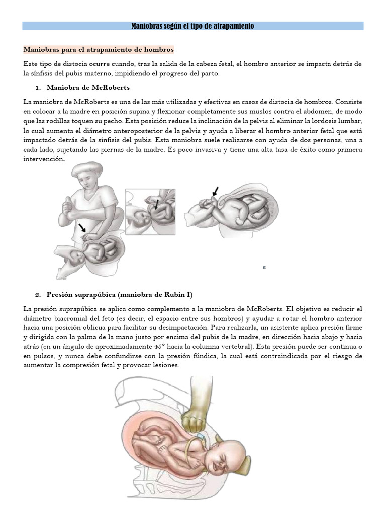 Maniobras para Atrapamiento Fetal | PDF | Parto | Especialidades Medicas